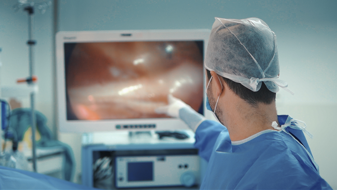 VÍDEO: HIPERIDROSE: COMO LIDAR COM O SUOR EXCESSIVO. - Icator